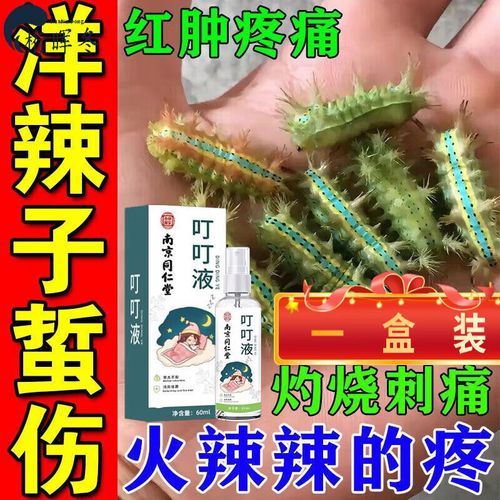 毛毛虫蛰伤怎么缓解疼痛_被毛毛虫蛰了怎么办-第2张图片-山城妙识 毛毛虫蛰伤怎么缓解疼痛_被毛毛虫蛰了怎么办-第2张图片-山城妙识