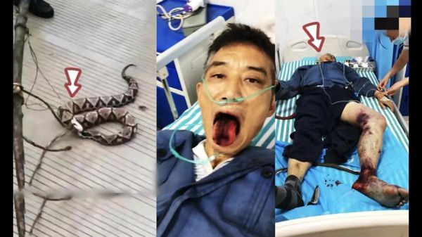 五步蛇咬伤图片_五步蛇咬伤症状多久出现-第1张图片-山城妙识