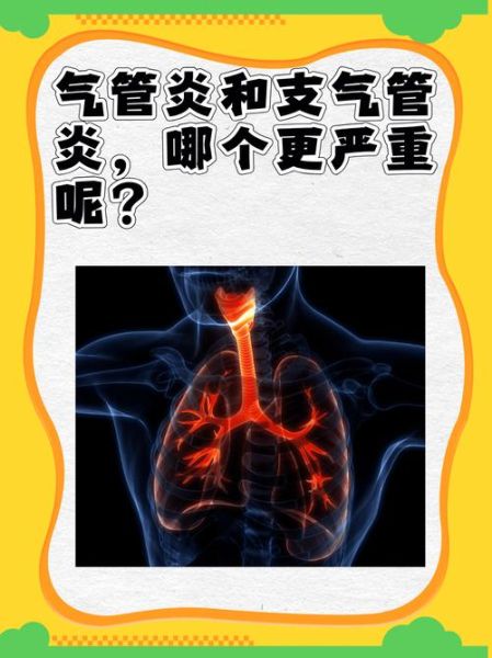 气管炎和支气管炎的区别_哪个更严重-第1张图片-山城妙识