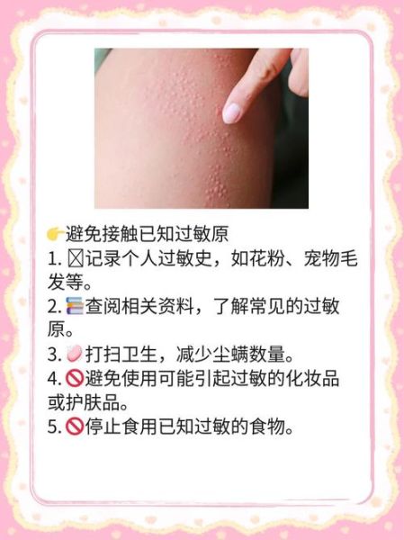 皮肤过敏怎么办_快速止痒小妙招-第2张图片-山城妙识