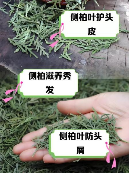 侧柏叶泡酒擦头有什么副作用_侧柏叶泡酒擦头会脱发吗-第3张图片-山城妙识 侧柏叶泡酒擦头有什么副作用_侧柏叶泡酒擦头会脱发吗-第3张图片-山城妙识