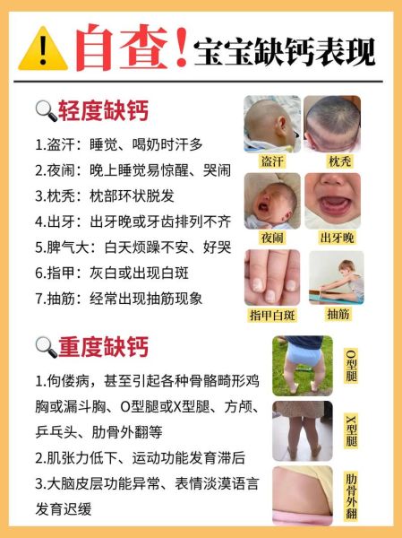 如何科学补钙_缺钙有哪些症状-第1张图片-山城妙识