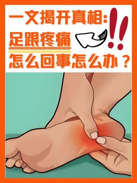 foot疼痛是怎么回事_foot疼痛如何缓解-第1张图片-山城妙识 foot疼痛是怎么回事_foot疼痛如何缓解-第1张图片-山城妙识
