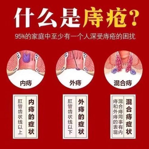 痔疮出血吃什么好_痔疮出血食疗偏方-第1张图片-山城妙识 痔疮出血吃什么好_痔疮出血食疗偏方-第1张图片-山城妙识