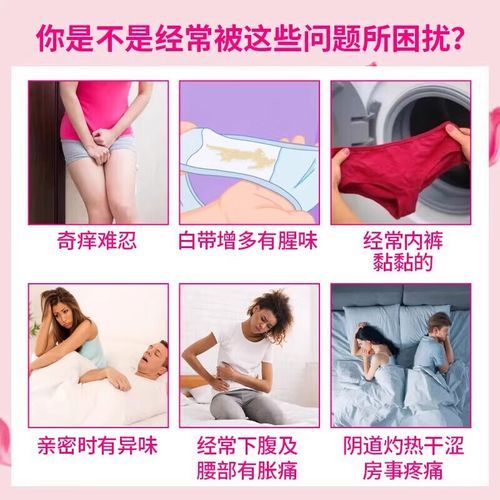 豆渣样白带用什么药效果好_豆渣样白带怎么根治-第1张图片-山城妙识 豆渣样白带用什么药效果好_豆渣样白带怎么根治-第1张图片-山城妙识