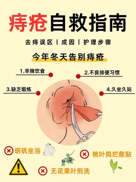 痔疮肉球缩回去小窍门_痔疮肉球怎么消除-第2张图片-山城妙识 痔疮肉球缩回去小窍门_痔疮肉球怎么消除-第2张图片-山城妙识