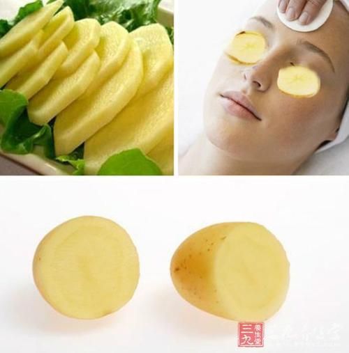 土豆片去黑眼圈敷多久_多久见效-第2张图片-山城妙识 土豆片去黑眼圈敷多久_多久见效-第2张图片-山城妙识