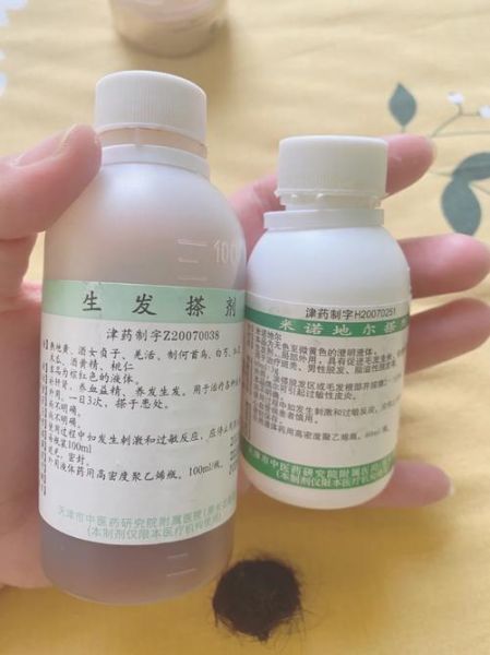 头发稀少怎么补救_头发稀少用什么药效果好-第2张图片-山城妙识 头发稀少怎么补救_头发稀少用什么药效果好-第2张图片-山城妙识