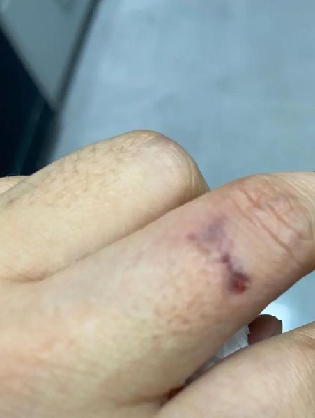 螃蟹怎么抓不会被夹_抓螃蟹不夹手技巧-第2张图片-山城妙识 螃蟹怎么抓不会被夹_抓螃蟹不夹手技巧-第2张图片-山城妙识