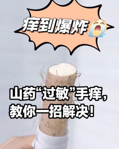 切了山药手特别痒怎么办_山药粘液引起手痒怎么快速止痒-第1张图片-山城妙识