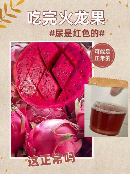 吃火龙果尿液变红正常吗_尿液变红图片解析-第1张图片-山城妙识