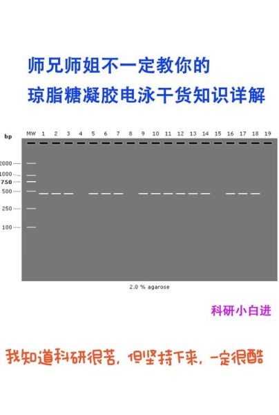 琼脂糖凝胶电泳条带模糊怎么办_如何准确判断DNA片段大小-第2张图片-山城妙识 琼脂糖凝胶电泳条带模糊怎么办_如何准确判断DNA片段大小-第2张图片-山城妙识