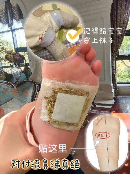 炒姜末敷脚心多久见效_宝宝流鼻涕能用吗-第3张图片-山城妙识
