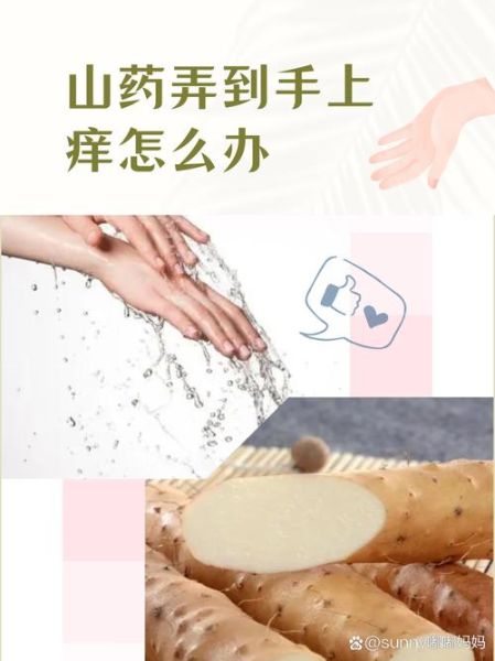 碰到山药痒怎么办_最快止痒方法-第2张图片-山城妙识