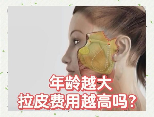 做个拉皮手术大概需要多少钱_拉皮手术价格影响因素-第3张图片-山城妙识 做个拉皮手术大概需要多少钱_拉皮手术价格影响因素-第3张图片-山城妙识