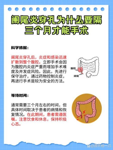 阑尾炎一定要手术吗_不手术会怎样-第3张图片-山城妙识 阑尾炎一定要手术吗_不手术会怎样-第3张图片-山城妙识