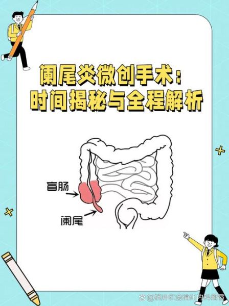 阑尾炎一定要手术吗_不手术会怎样-第1张图片-山城妙识 阑尾炎一定要手术吗_不手术会怎样-第1张图片-山城妙识