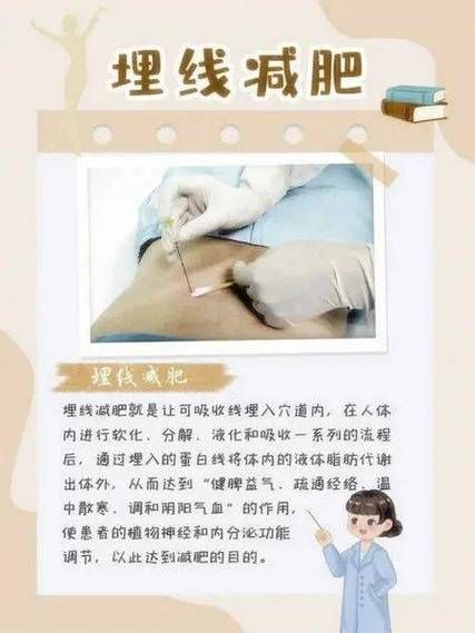 经络埋线减肥多久见效_经络埋线减肥安全吗-第1张图片-山城妙识