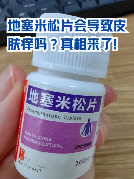 醋酸地塞米松片是激素药吗_副作用有哪些-第2张图片-山城妙识 醋酸地塞米松片是激素药吗_副作用有哪些-第2张图片-山城妙识