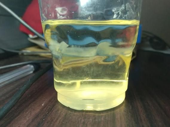 怀孕尿里加醋测男女准吗_怀孕尿里加醋测男女准确率-第1张图片-山城妙识