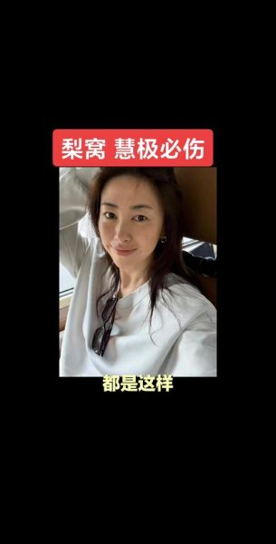 梨涡和酒窝的区别_梨涡和酒窝哪个好看-第3张图片-山城妙识