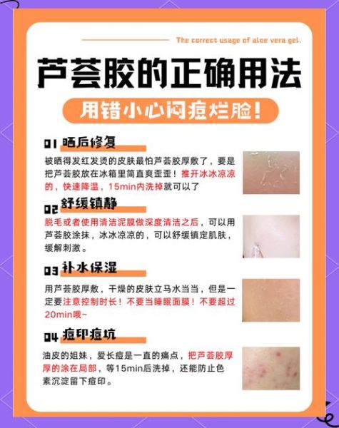 芦荟胶能祛痘吗_芦荟胶能去痘印吗-第1张图片-山城妙识