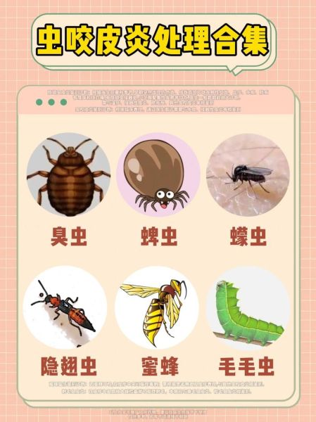 最吓人的虫子有哪些_如何防止被咬-第1张图片-山城妙识