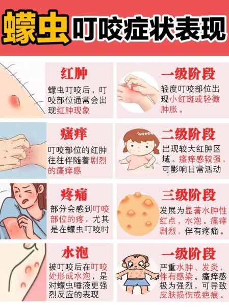 最吓人的虫子有哪些_如何防止被咬-第2张图片-山城妙识