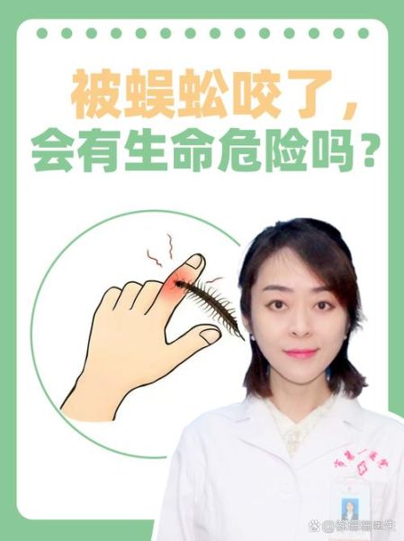 最吓人的虫子有哪些_如何防止被咬-第3张图片-山城妙识