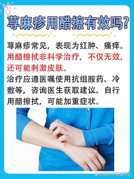 盐水能治好荨麻疹吗_盐水止痒多久见效-第1张图片-山城妙识