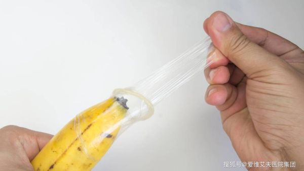 鱼鳔避孕套是什么_鱼鳔避孕套安全吗-第3张图片-山城妙识