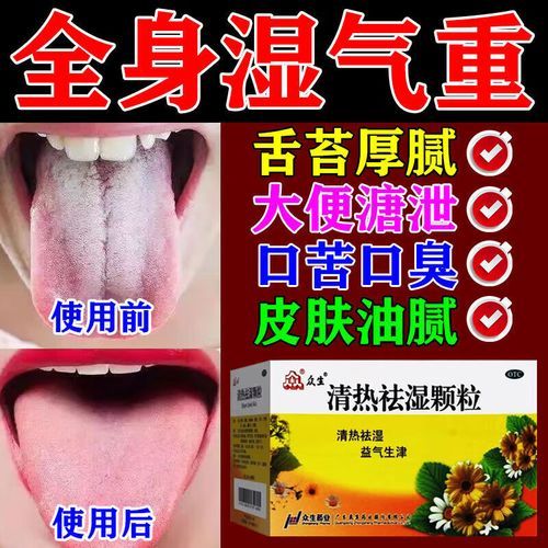 祛湿颗粒的功效与作用_祛湿颗粒适合什么人吃-第1张图片-山城妙识 祛湿颗粒的功效与作用_祛湿颗粒适合什么人吃-第1张图片-山城妙识