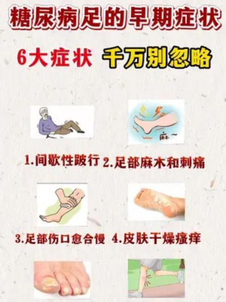 如何判断自己是否得了糖尿病_糖尿病早期症状有哪些-第1张图片-山城妙识 如何判断自己是否得了糖尿病_糖尿病早期症状有哪些-第1张图片-山城妙识