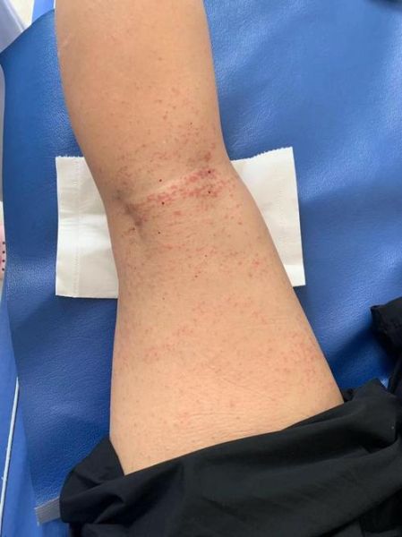 海蜇什么人不能吃_海蜇过敏症状有哪些-第1张图片-山城妙识 海蜇什么人不能吃_海蜇过敏症状有哪些-第1张图片-山城妙识