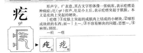 疙瘩拼音怎么拼_疙瘩拼音几声调-第1张图片-山城妙识 疙瘩拼音怎么拼_疙瘩拼音几声调-第1张图片-山城妙识