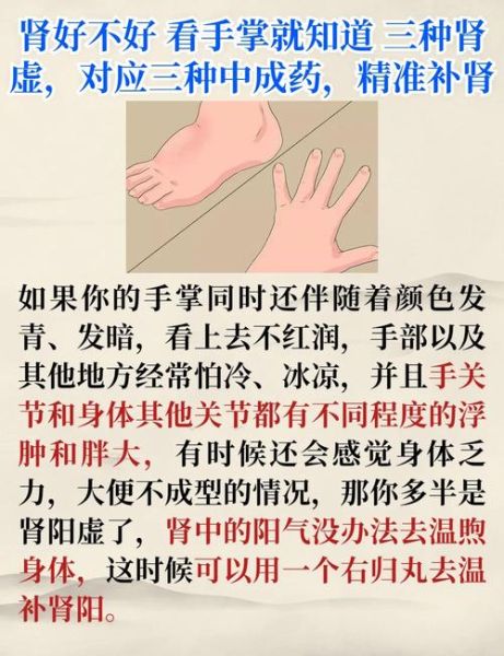 过度手浮是阴虚还是阳虚_怎么调理-第1张图片-山城妙识 过度手浮是阴虚还是阳虚_怎么调理-第1张图片-山城妙识