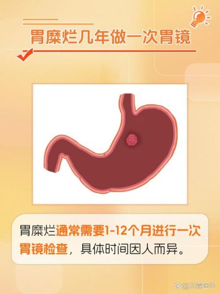 糜烂性胃炎会癌变吗_多久复查一次胃镜-第1张图片-山城妙识 糜烂性胃炎会癌变吗_多久复查一次胃镜-第1张图片-山城妙识