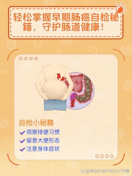 早期肠癌自检方法_如何在家发现肠癌信号-第1张图片-山城妙识 早期肠癌自检方法_如何在家发现肠癌信号-第1张图片-山城妙识