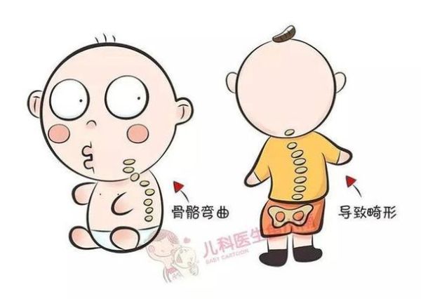 婴儿佝偻病睡姿图片_佝偻病宝宝正确睡姿-第2张图片-山城妙识 婴儿佝偻病睡姿图片_佝偻病宝宝正确睡姿-第2张图片-山城妙识