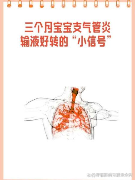 支气管炎多久能好_支气管炎好转的三个阶段-第2张图片-山城妙识